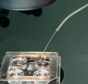 Assisted Reproduction: Your Comprehensive Guide